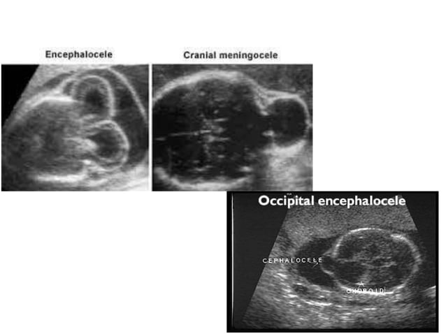 Normal and abnormal of Obstetric , Slidshare ppt.pptx