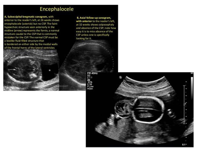 Normal and abnormal of Obstetric , Slidshare ppt.pptx