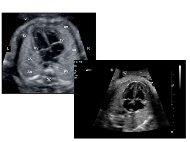 Normal and abnormal of Obstetric , Slidshare ppt.pptx