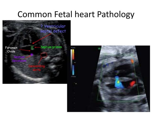 Normal and abnormal of Obstetric , Slidshare ppt.pptx