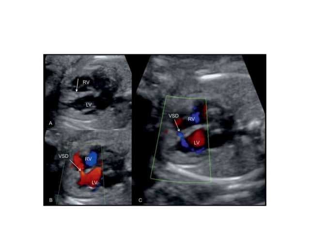 Normal and abnormal of Obstetric , Slidshare ppt.pptx