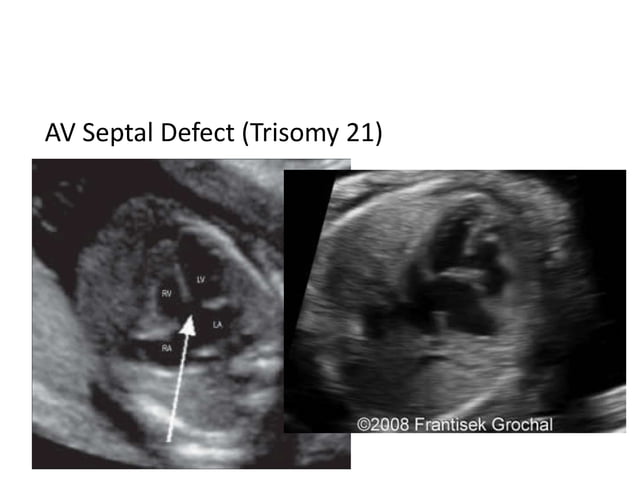 Normal and abnormal of Obstetric , Slidshare ppt.pptx