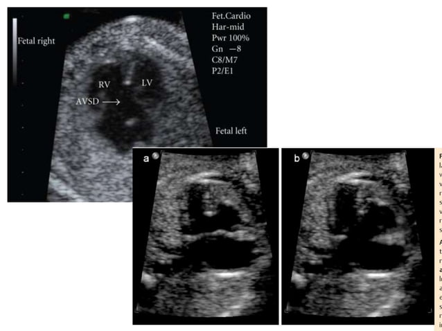 Normal and abnormal of Obstetric , Slidshare ppt.pptx