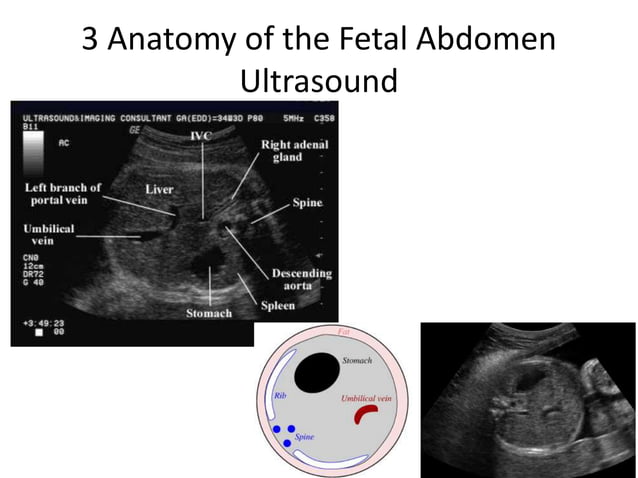 Normal and abnormal of Obstetric , Slidshare ppt.pptx