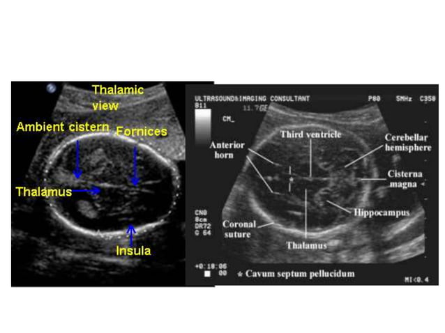 Normal and abnormal of Obstetric , Slidshare ppt.pptx