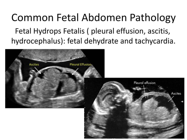 Normal and abnormal of Obstetric , Slidshare ppt.pptx