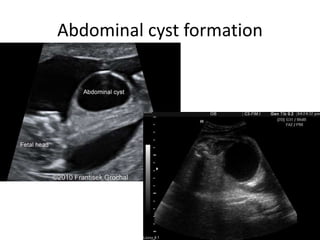 Normal and abnormal of Obstetric , Slidshare ppt.pptx