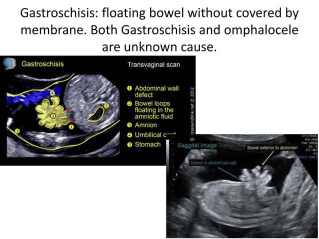 Normal and abnormal of Obstetric , Slidshare ppt.pptx
