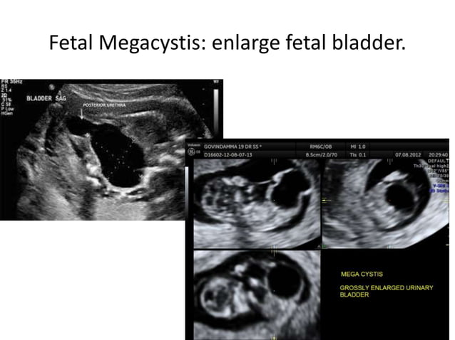 Normal and abnormal of Obstetric , Slidshare ppt.pptx