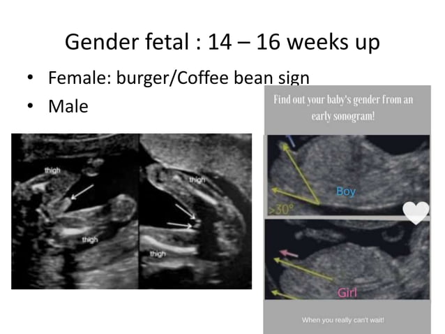 Normal and abnormal of Obstetric , Slidshare ppt.pptx