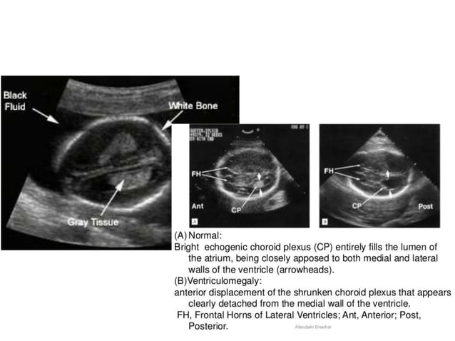 Normal and abnormal of Obstetric , Slidshare ppt.pptx