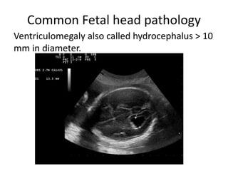 Normal and abnormal of Obstetric , Slidshare ppt.pptx