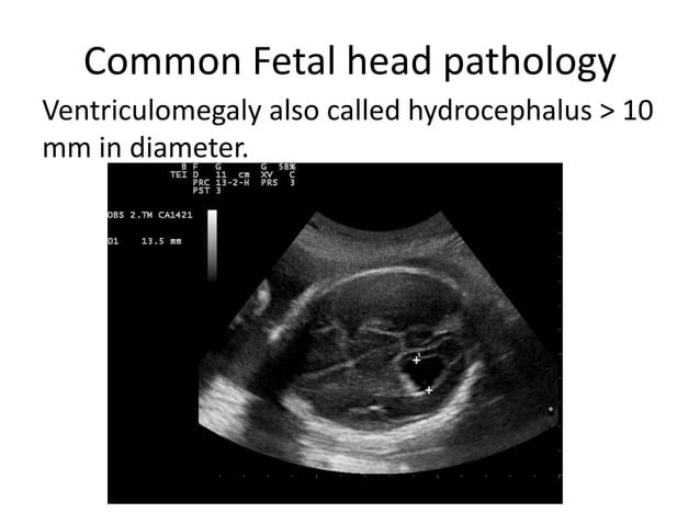 Normal and abnormal of Obstetric , Slidshare ppt.pptx