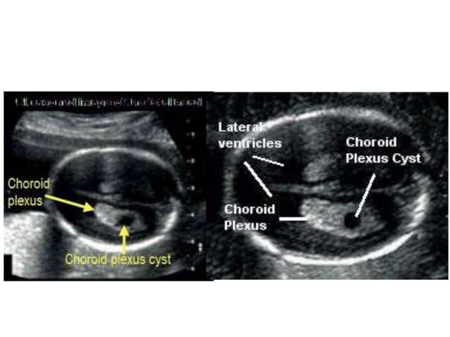 Normal and abnormal of Obstetric , Slidshare ppt.pptx