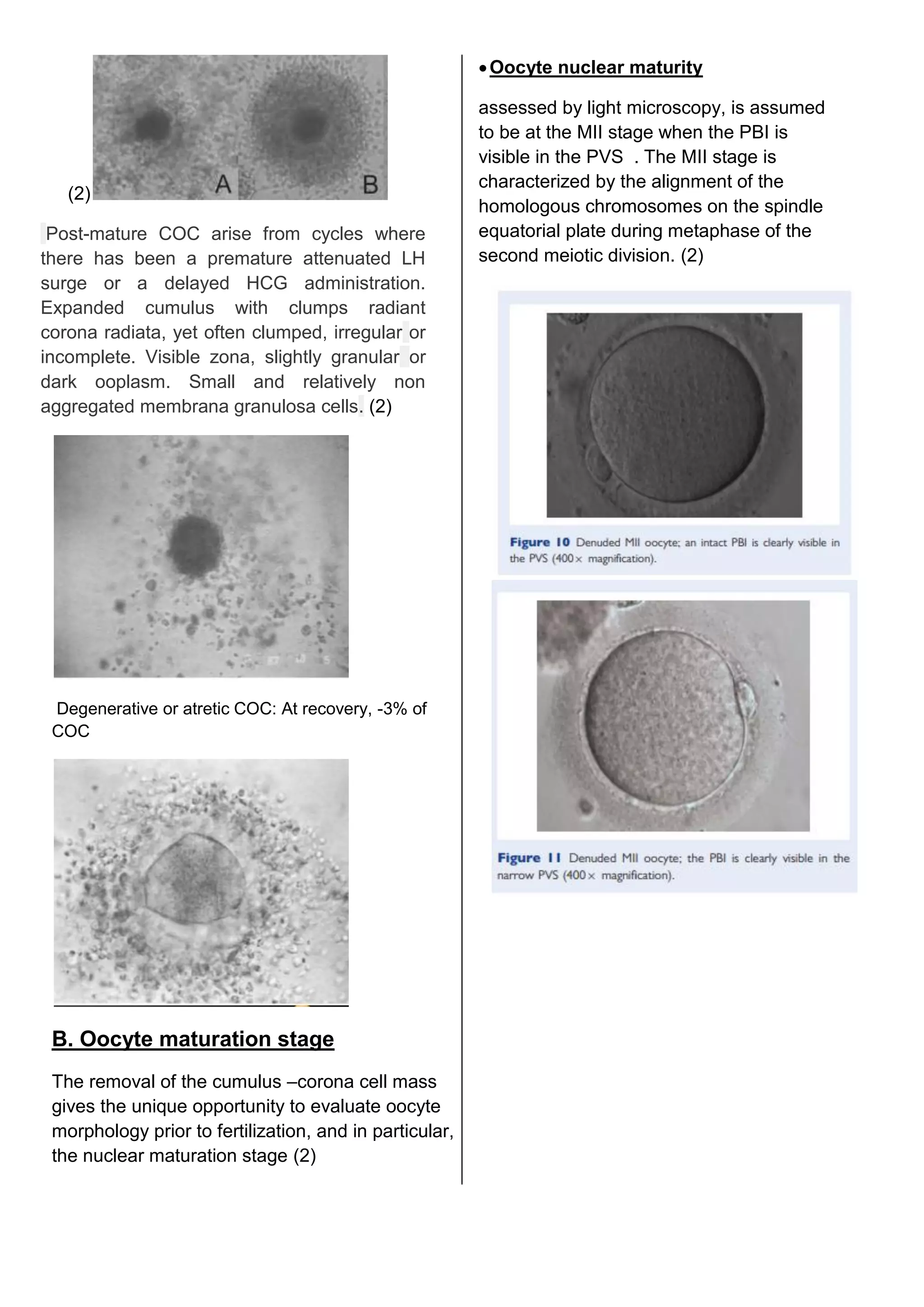 Normal and abnormal oocyte morphology | PDF