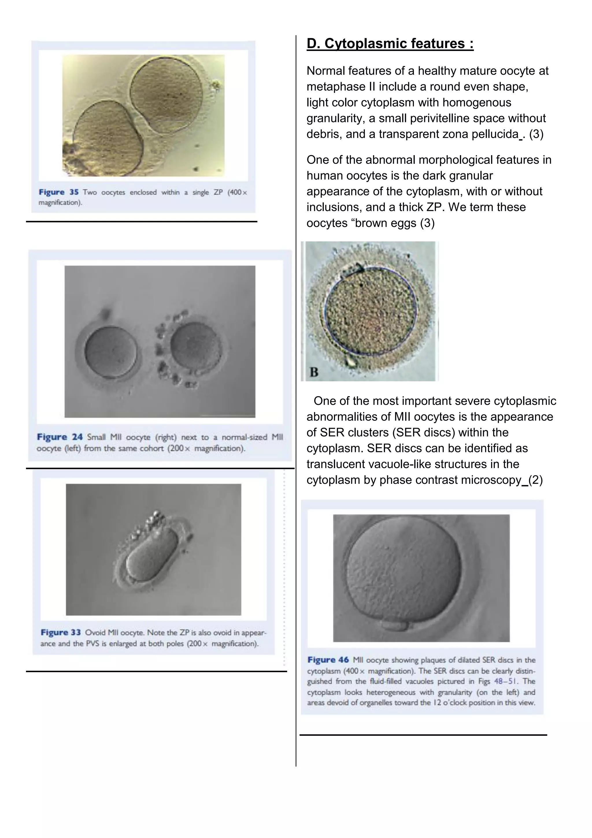 Normal and abnormal oocyte morphology | PDF