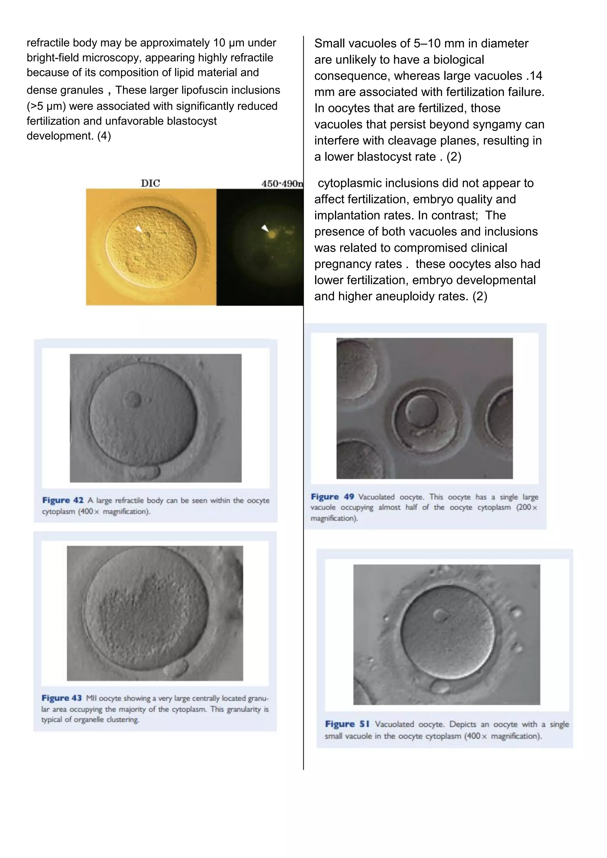 Normal and abnormal oocyte morphology | PDF