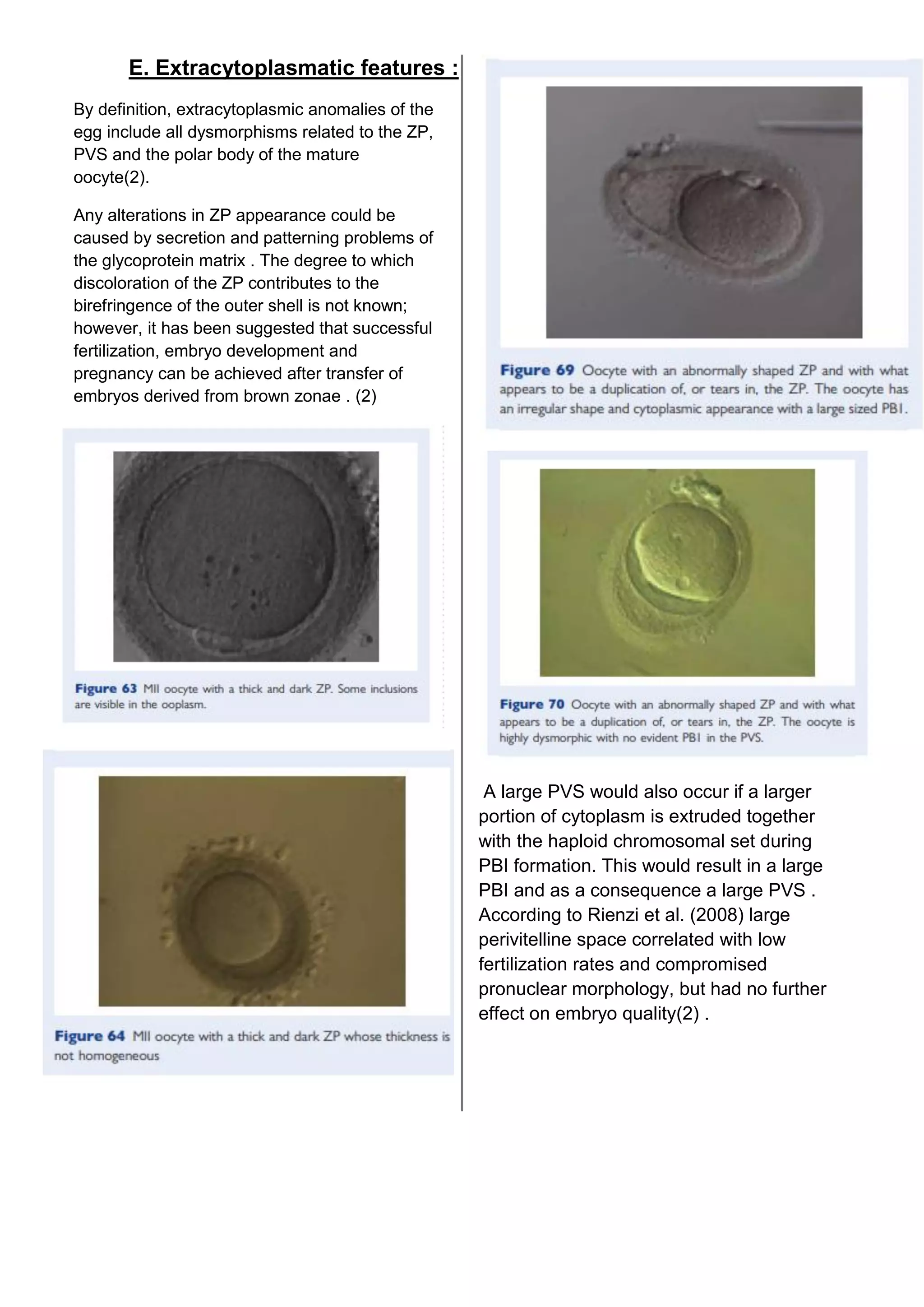 Normal and abnormal oocyte morphology | PDF