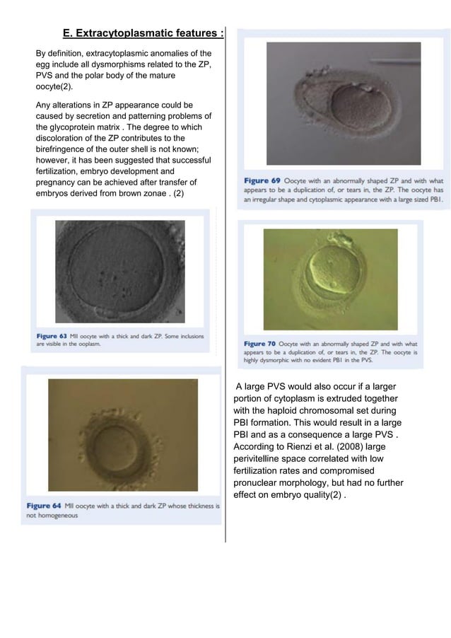 Normal and abnormal oocyte morphology | PDF