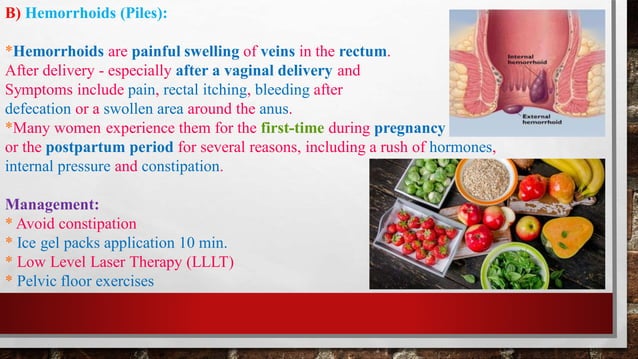 Normal and Abnormal Puerperium & Postnatal Physical Therapy Care | PPT
