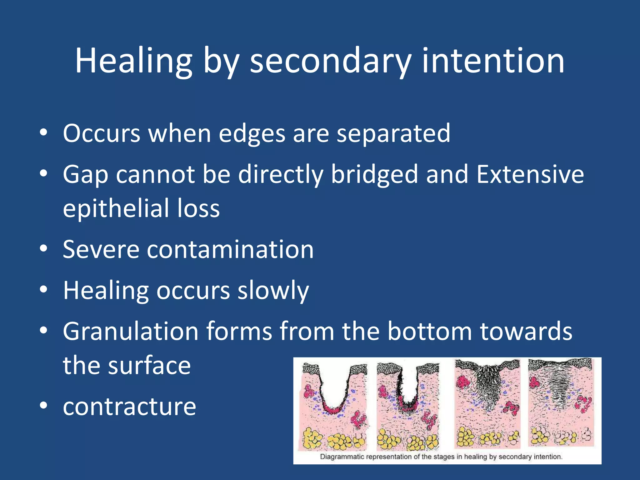 Normal and abnormal wound heaing | PPTX