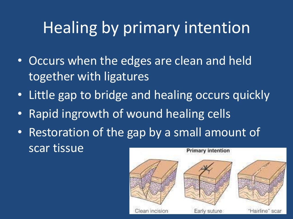 Normal and abnormal wound heaing
