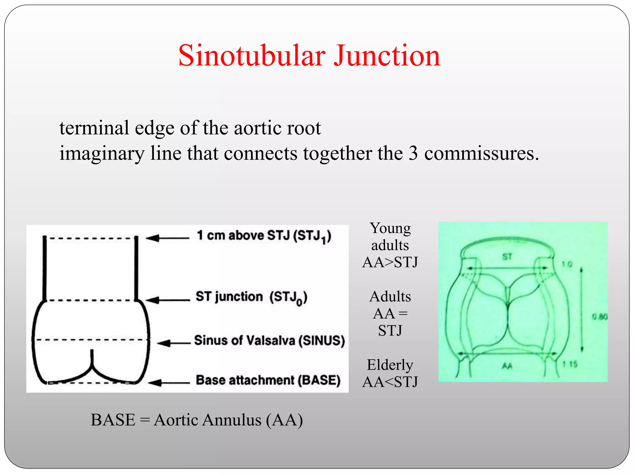 Normal aortic valve echocardiogram | PPTX