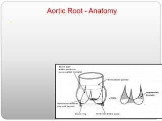 Normal aortic valve echocardiogram | PPTX
