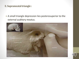 Norma lateralis | PPTX