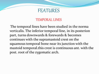 NORMA_LATERALIS.pptx