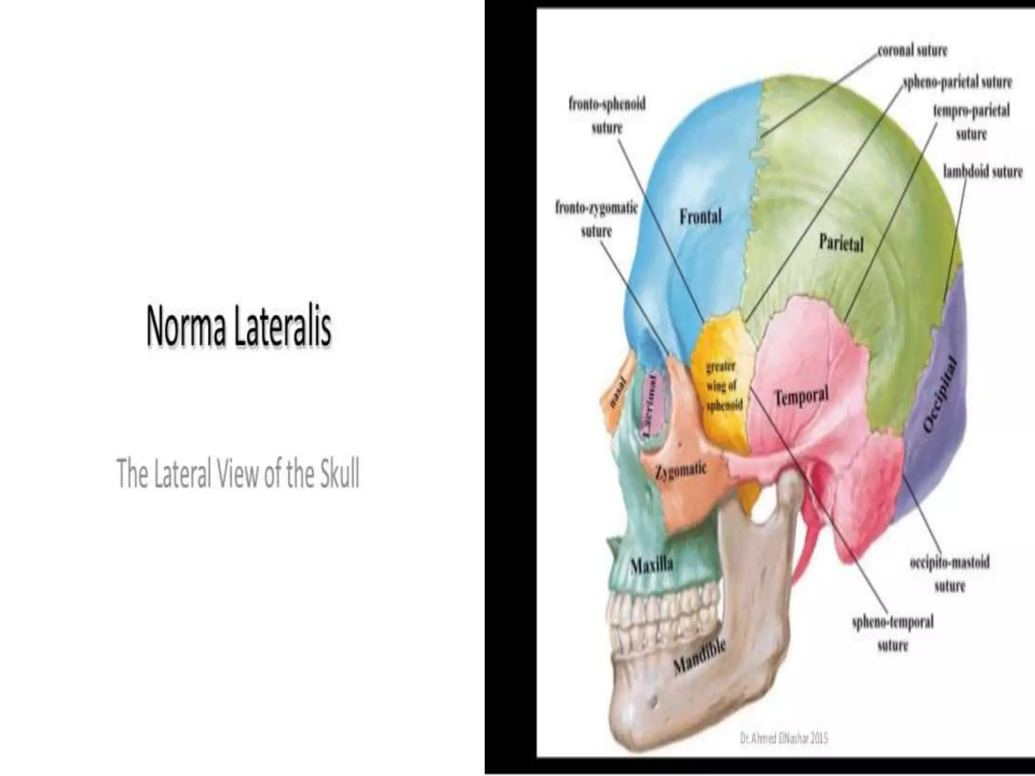 Norma lateralis & foetal skull2018 | PPTX