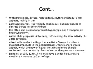 Normal awake and sleep EEG | PPT
