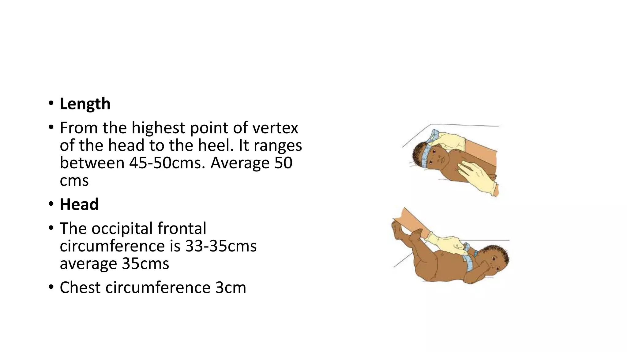NORMAL BABY.pptx