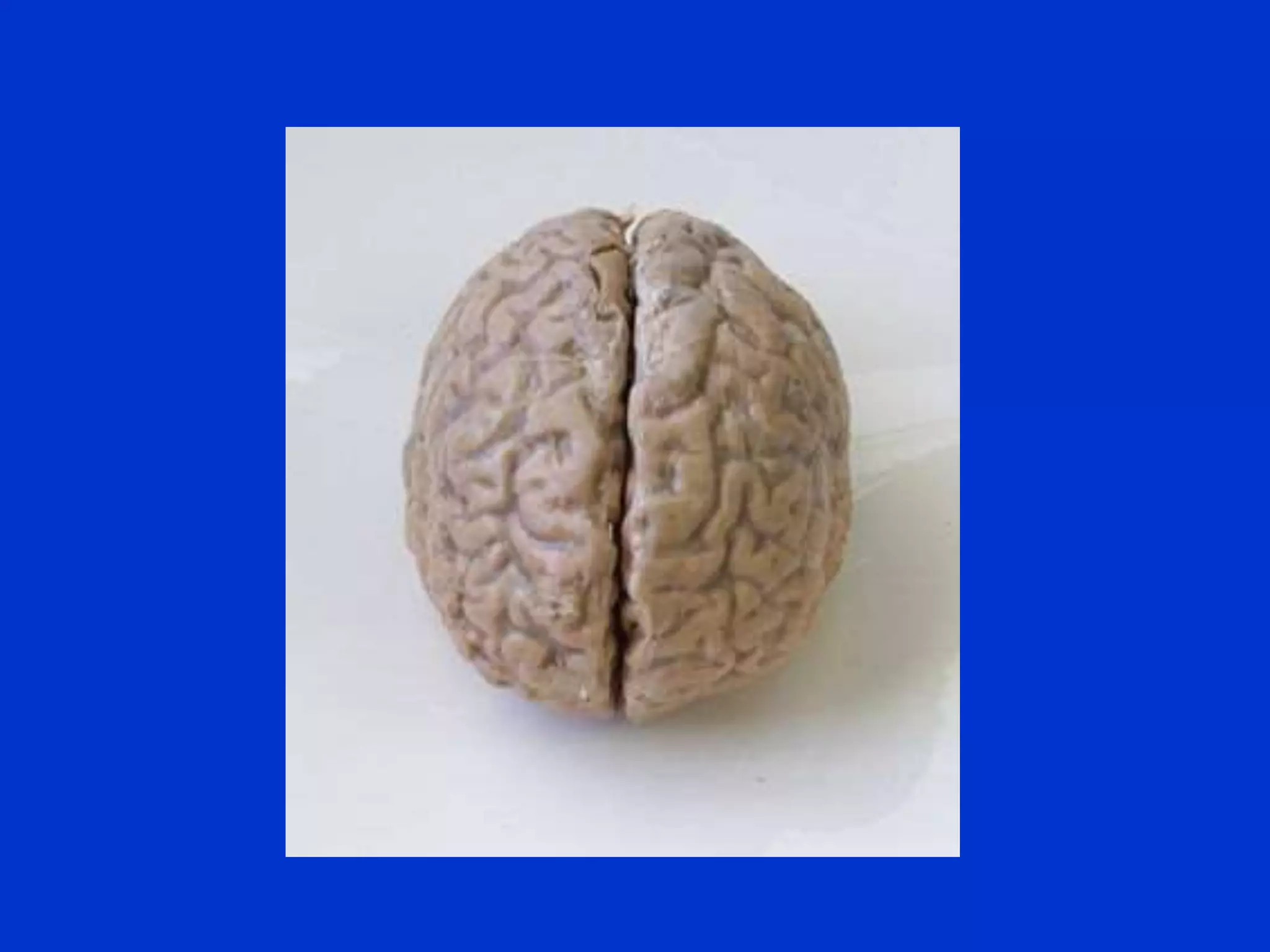 NORMAL BRAIN ANATOMY 2.ppt | Free Download