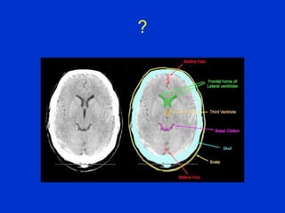NORMAL BRAIN ANATOMY 2.ppt