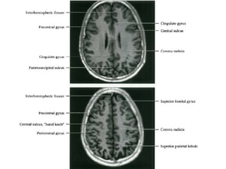Normal brain & vascualar anatomy human body radiology imaging.pptx
