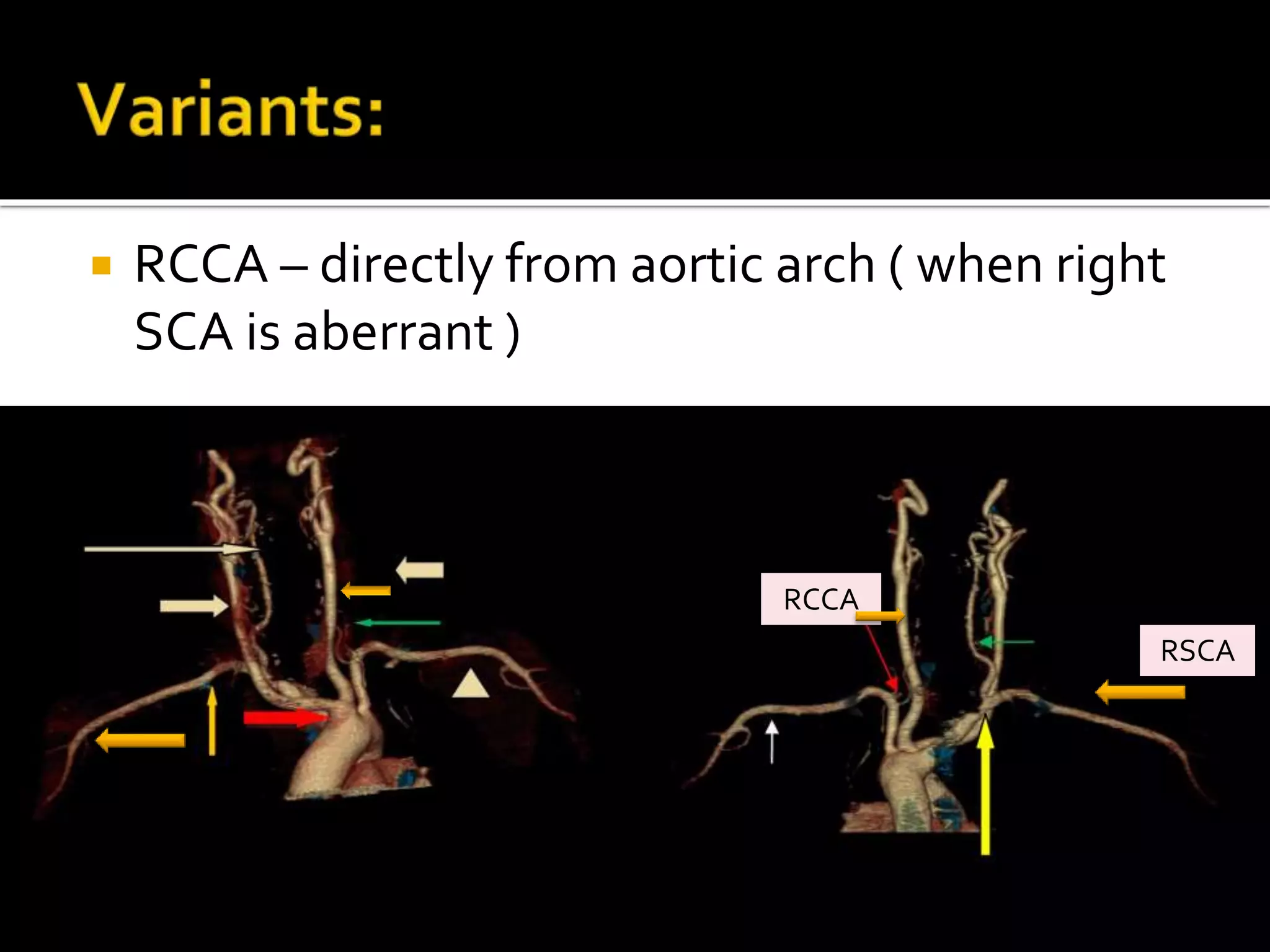 Normal cerebral angiogram final | PPTX