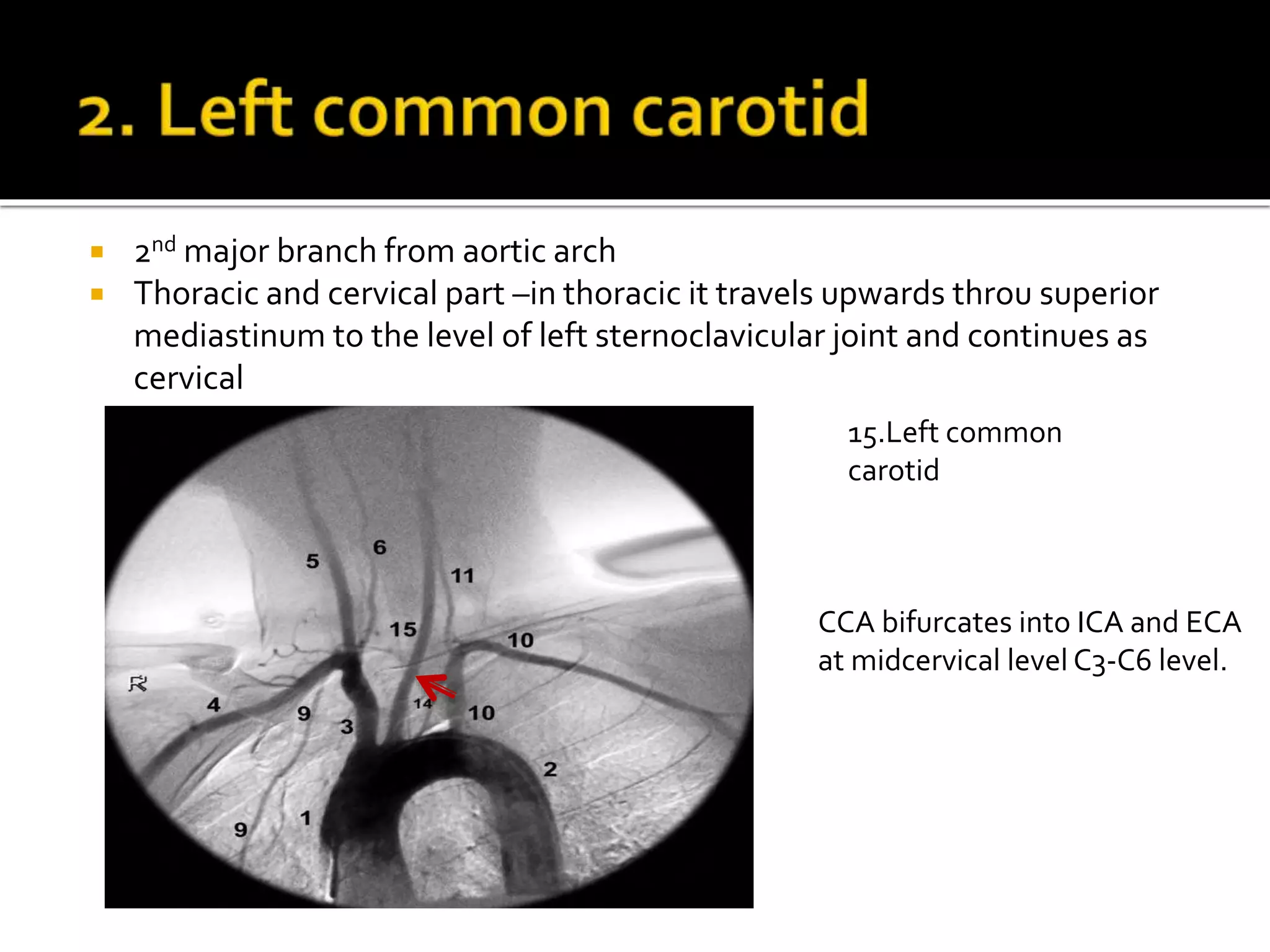 Normal cerebral angiogram final | PPTX