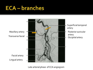 Normal cerebral angiogram final | PPTX