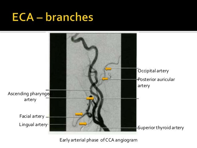 Normal cerebral angiogram final