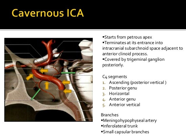 Normal cerebral angiogram final