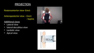 NORMAL CHEST RADIOGRAPGH AND ANATOMY.pptx.pptx | Medical Tests ...