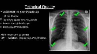 NORMAL CHEST RADIOGRAPGH AND ANATOMY.pptx.pptx