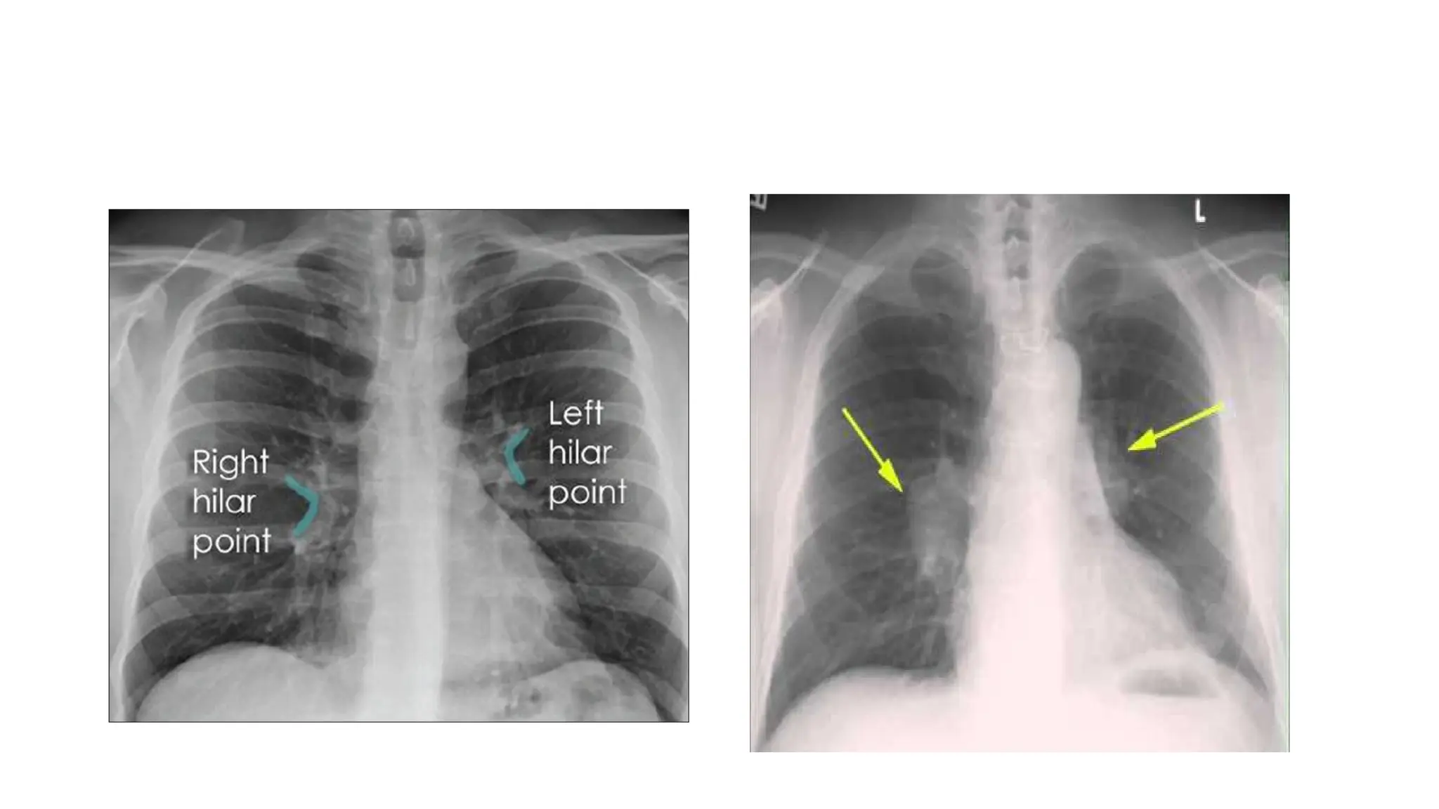 NORMAL CHEST RADIOGRAPH 23-0 7-2019.pptx
