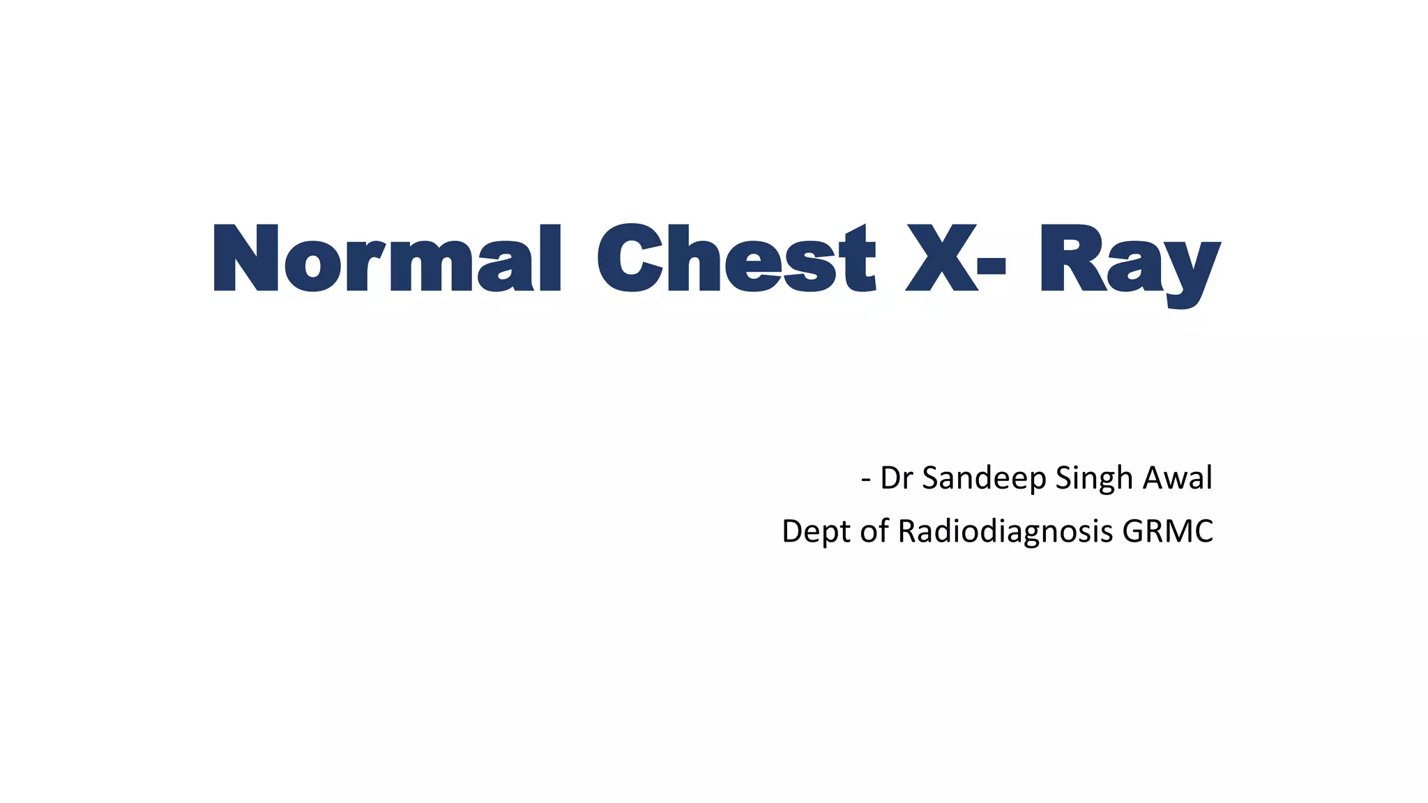 Normal chest x ray- Radiology Basics | PPTX