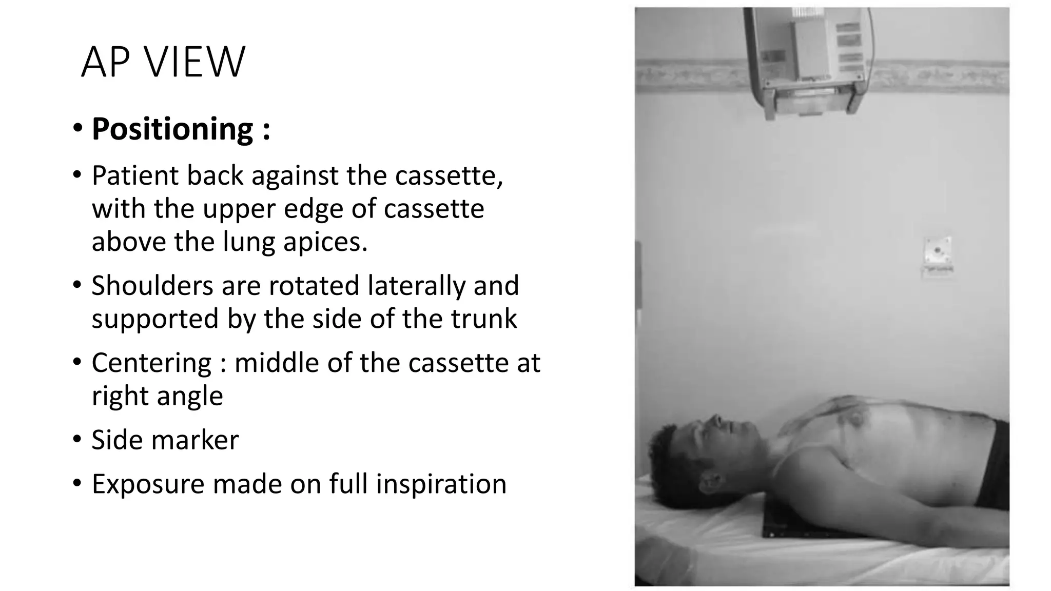 Normal chest x ray- Radiology Basics | PPTX
