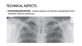 Normal chest x ray- Radiology Basics | PPTX