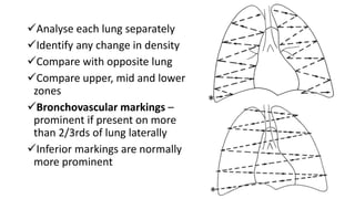Normal chest x ray- Radiology Basics | PPTX