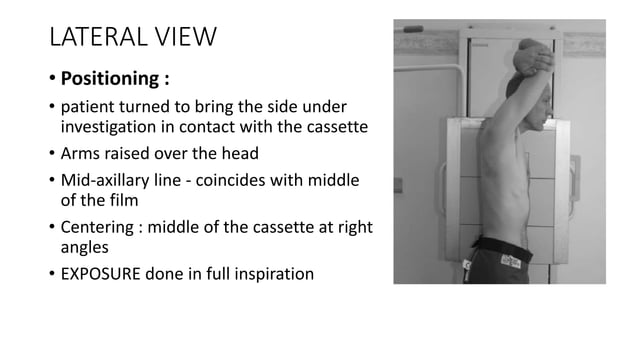 Normal chest x ray- Radiology Basics | PPTX | Lung and Respiratory ...