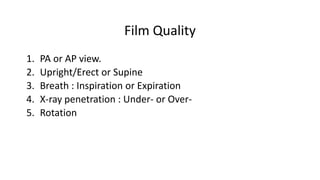 Normal chest x ray- Radiology Basics | PPTX